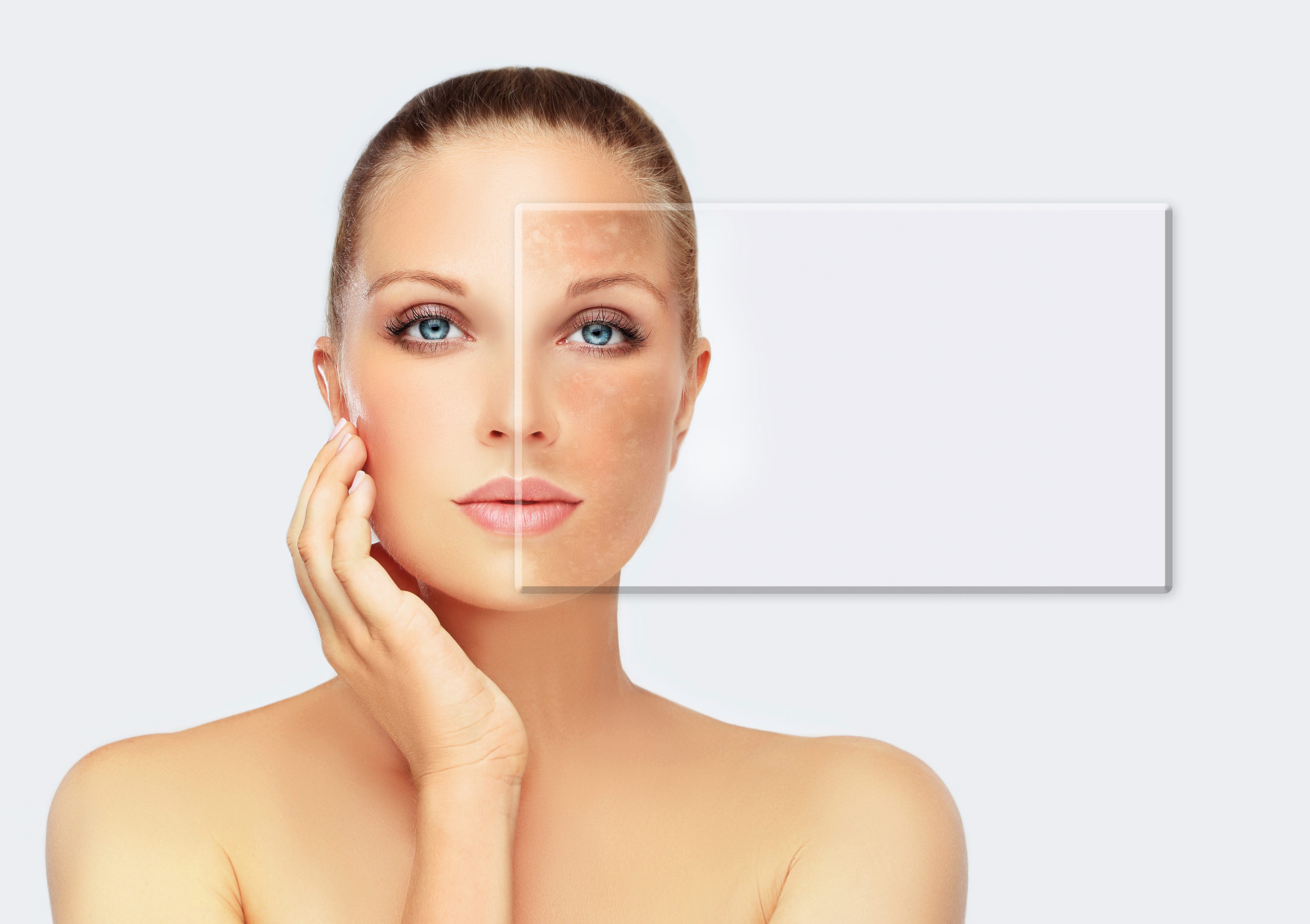 Laser Genesis in La Jolla, CA | Torrey Pines Dermatology