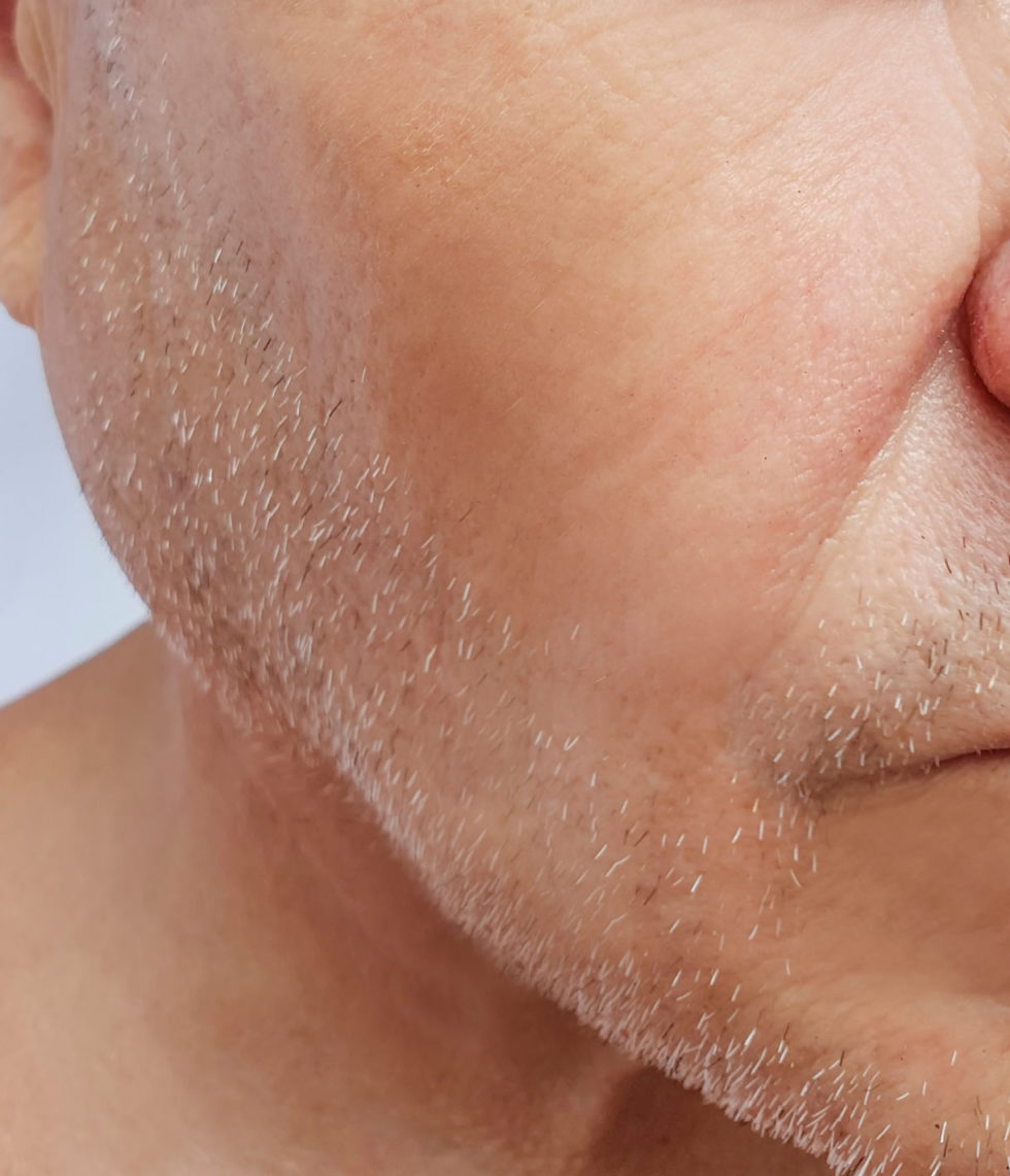 ActiveFX Skin Rejuvenation | La Jolla | Torrey Pines Dermatology