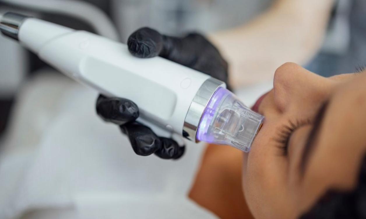 Potenza RF Microneedling in La Jolla | Torrey Pines Dermatology